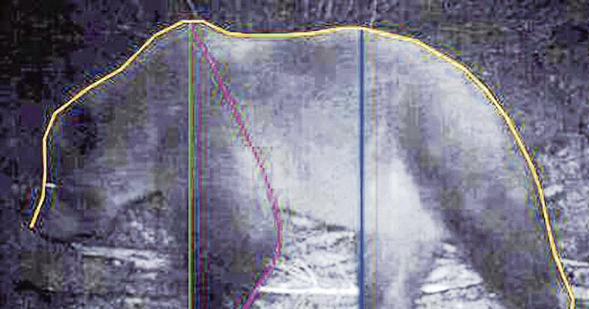 ENCUESTA. ¿Qué crees que se tiene que hacer con el oso Goiat?